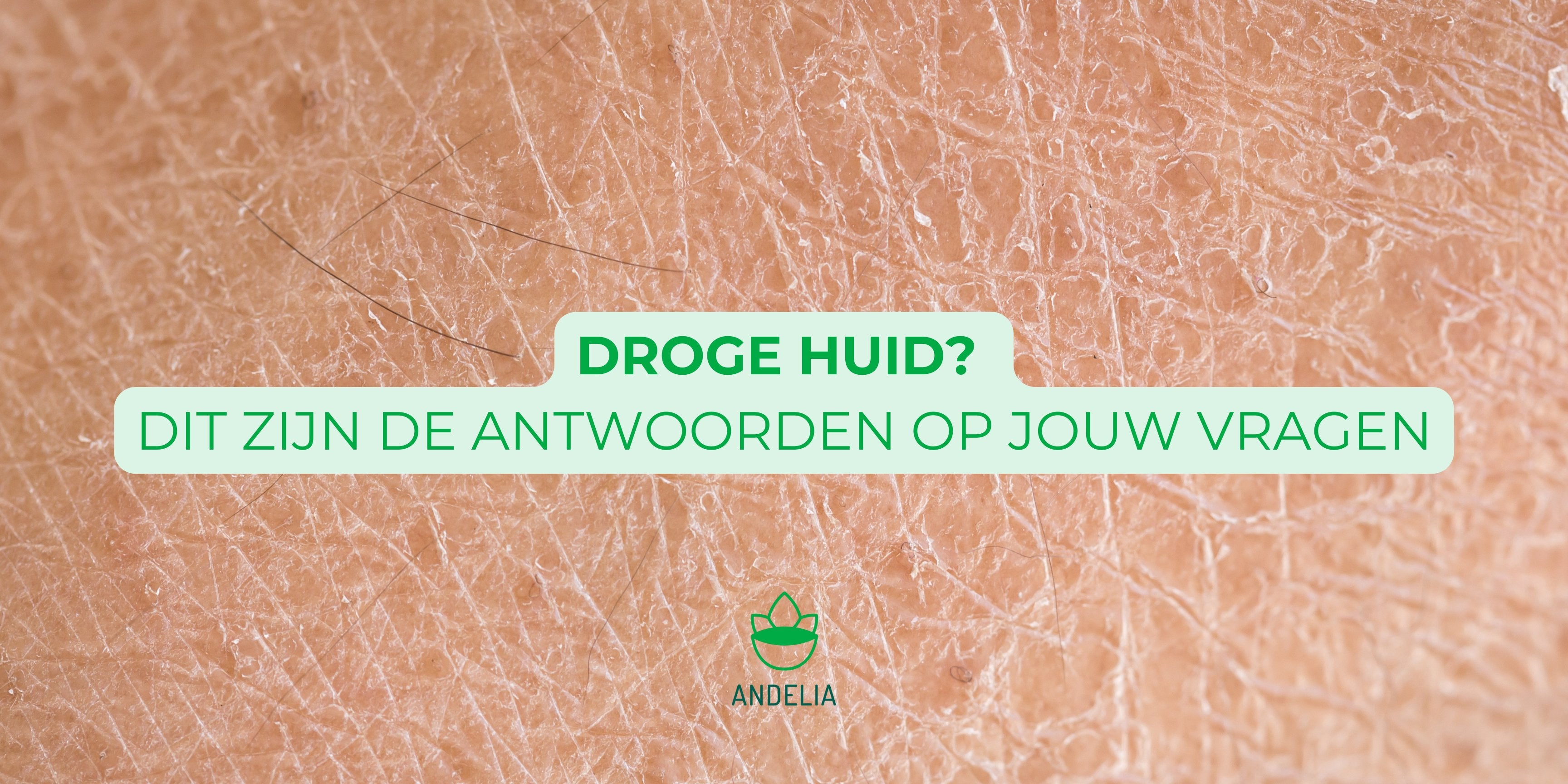 Droge huid? Dit zijn de antwoorden op jouw vragen - Andelia